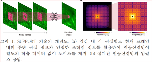 KAIST, 10배 이상 생체신호 정밀 측정 ‘SUPPORT’개발